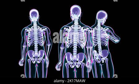 Three skeletons standing and moving normally isolated on black ...