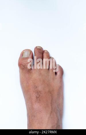 Toes, hands and nails. Male human body parts 20 to 30 years old Stock ...