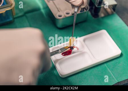 Platelet rich fibrin Stock Photo - Alamy
