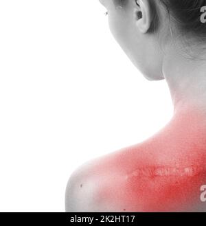 Scar after operation on back of women on white background, big scar on ...
