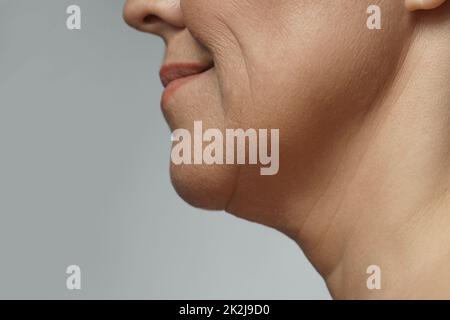 Closeup of female chin and neck with expression lines Stock Photo - Alamy