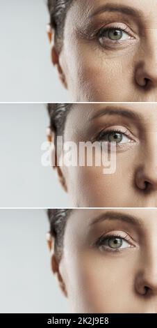 Female face after incredible rejuvenation process or heavy retouching ...