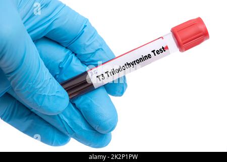 T3 Triiodothyronine Test Medical check up test tube with biological ...