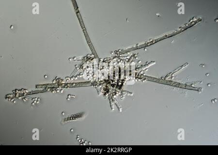 Mold filaments and spores Stock Photo - Alamy
