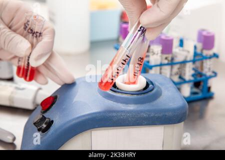 Scientist using a vortex to mix contents in a test tube. Scientist ...
