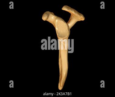 CT Shoulder 3D of Computed Tomography Volume Rendering examination of ...