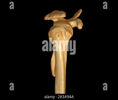 CT Shoulder 3D of Computed Tomography Volume Rendering examination of ...