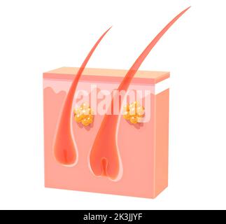 Human skin showing sebaceous glands. Longitudinal section. Optical ...