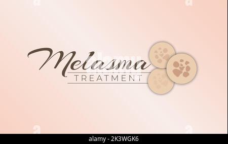 Melasma Laser Removal Background Illustration Stock Vector Image & Art ...