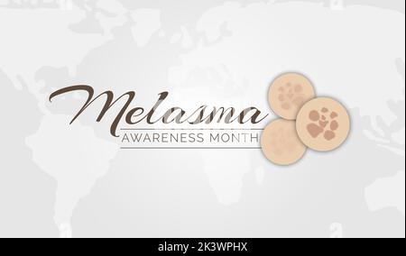 vector illustration of lightening of the skin. freckles, vitiligo ...