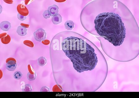 Prolymphocytic Leukemia (PLL) cancer cells - closeup view 3d ...