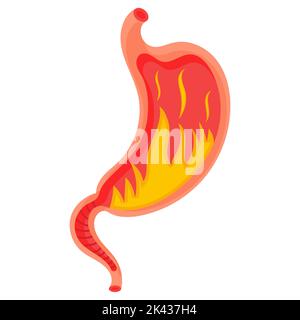 Full stomach. Heaviness of stomach, bloating, pain in the alimentary ...