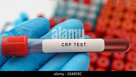 CRP C-Reactive Protein Test Medical check up test tube with biological ...