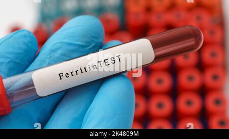 Ferritin Test Medical check up test tube with biological sample Stock ...