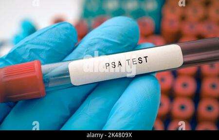 PSA-Prostate specific antigen blood test tube. A PSA test is used to ...