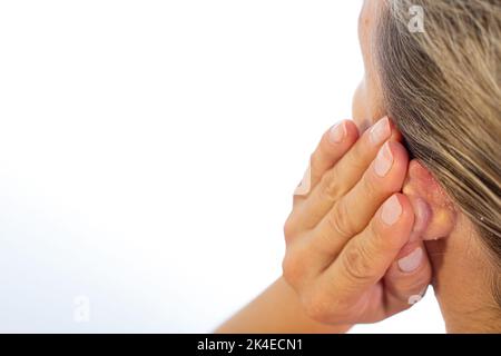 Psoriasis of the scalp , psoriatic redness, peeling and crusts on the ...