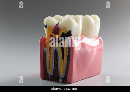 Teaching model of a tooth in cross section, close-up Stock Photo - Alamy