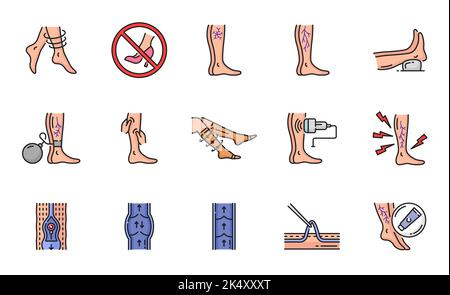 Varicose infographic. Venous disease medical health problems with human ...
