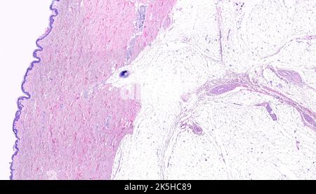 Light micrograph of thin skin showing form left to right, the epidermis ...