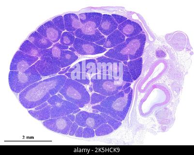 Low power light microscope micrograph showing a young thymus. The ...