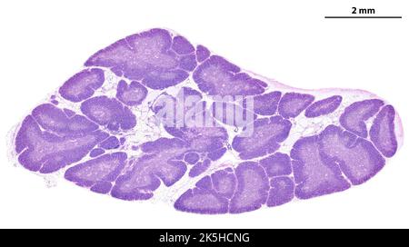 Light micrograph of a human thymus gland stained with haematoxylin and ...