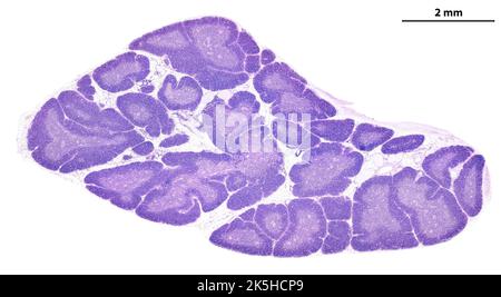 Thymus gland, light micrograph Stock Photo - Alamy