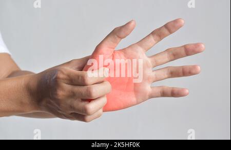Man scratching his itchy palm with rash Stock Photo - Alamy