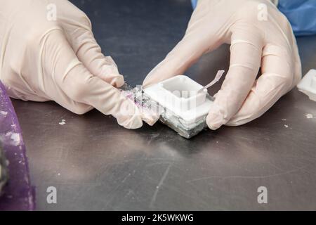 Paraffin blocks containing biopsy tissue for sectioning. Pathology ...