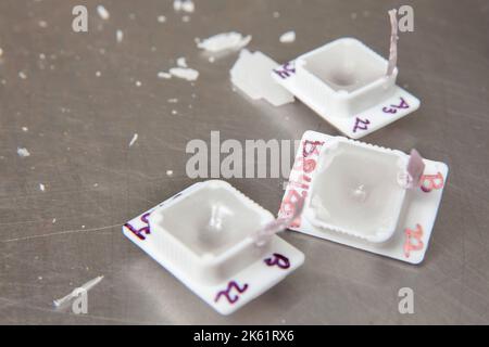Paraffin blocks containing biopsy tissue for sectioning. Pathology ...