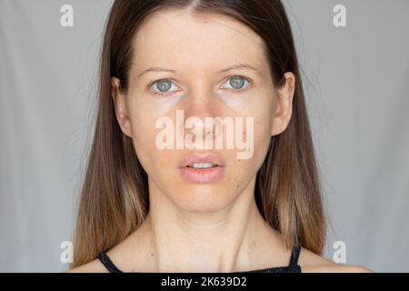 The face of a young Ukrainian girl without retouching, close-up Stock ...