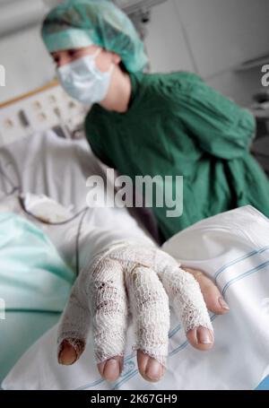 Patient being treated for his burns a burn center, University Hospital ...