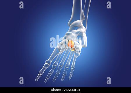 Lateral cuneiform bone, illustration Stock Photo - Alamy