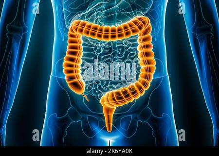 Human large intestine pain, illustration Stock Photo - Alamy