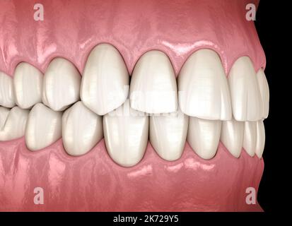 Healthy human teeth with normal occlusion, side view. Medically ...