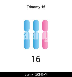 Scientific Designing of Mosaic Trisomy 18 Karyotype. Colorful Symbols ...