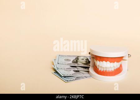Ceramic model of tooth and dollar banknotes on white background ...