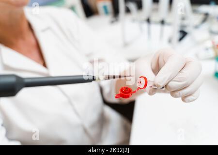 Using microdoser for blood analysis and test in laboratory. Medical ...
