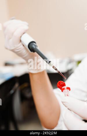 Laboratory assistant with microdoser in laboratory doing blood test ...