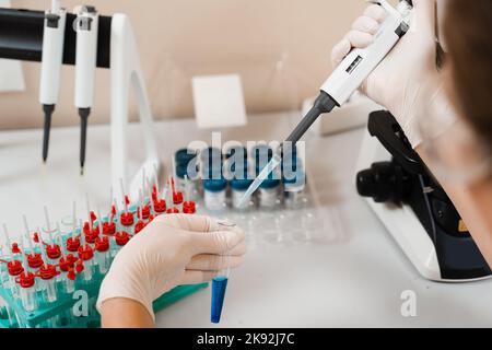 Laboratory assistant with microdoser in laboratory doing blood test ...