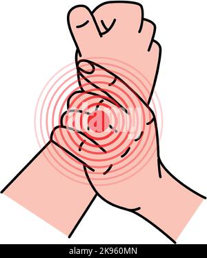 Illustration of muscle strain in human body Stock Vector Image & Art ...