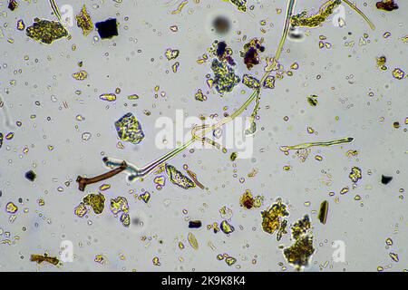 Fungal and fungi hyphae under the microscope in the soil and compost ...
