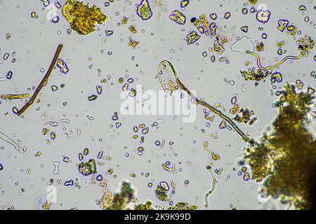 Fungal and fungi hyphae under the microscope in the soil and compost ...