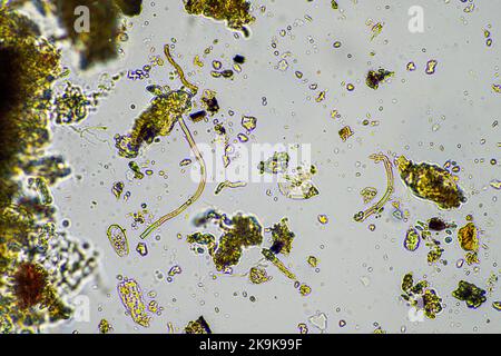 Fungal and fungi hyphae under the microscope in the soil and compost ...