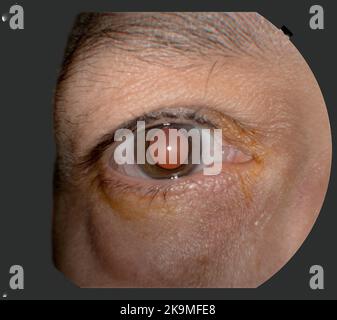 Photography of Human Eye Retina Stock Photo - Alamy