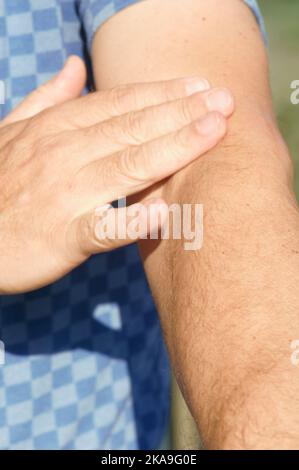 Topical pain of the elbows. Application of medical ointment on skin in ...