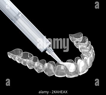 Teeth whitening kit, adding gel in to invisalign. 3D illustration ...