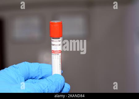 Cairo, Egypt, October 22 2022: Blood collection tube for collecting ...