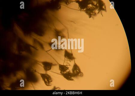Rhizopus fungi specimen as seen through a microscope Stock Photo - Alamy