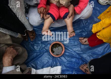 Kashmiri people take leech therapy on the eve of Nauroz (Persian New ...