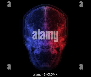 CTA brain or CT angiography of the brain 3D Rendering image for ...